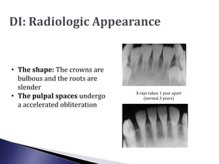 Dental management of Osteogenesis imperfecta.slideshare | PPTX