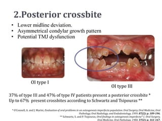 Dental management of Osteogenesis imperfecta.slideshare | PPTX