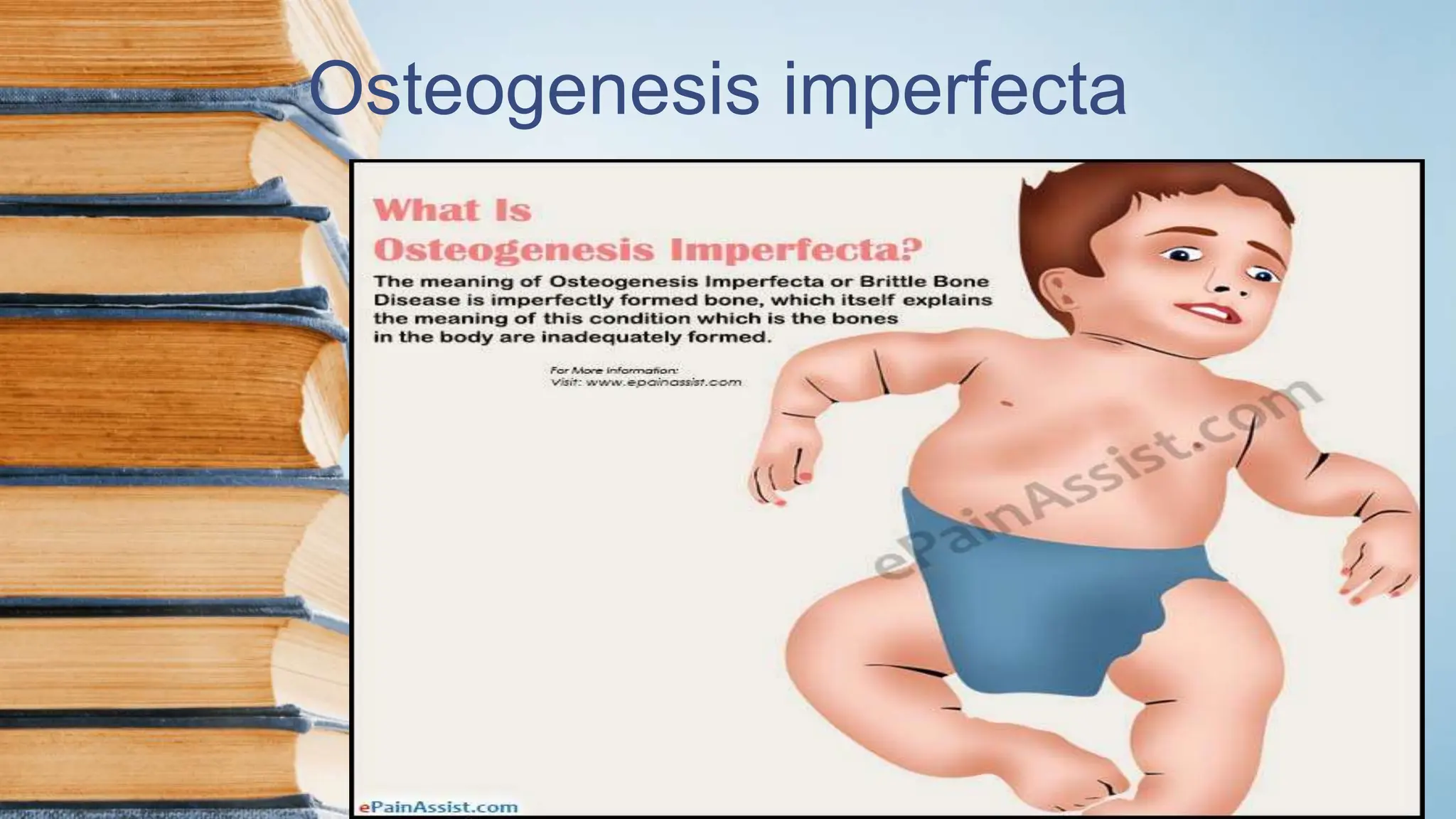osteogenisis imperfecta radiology...pptx