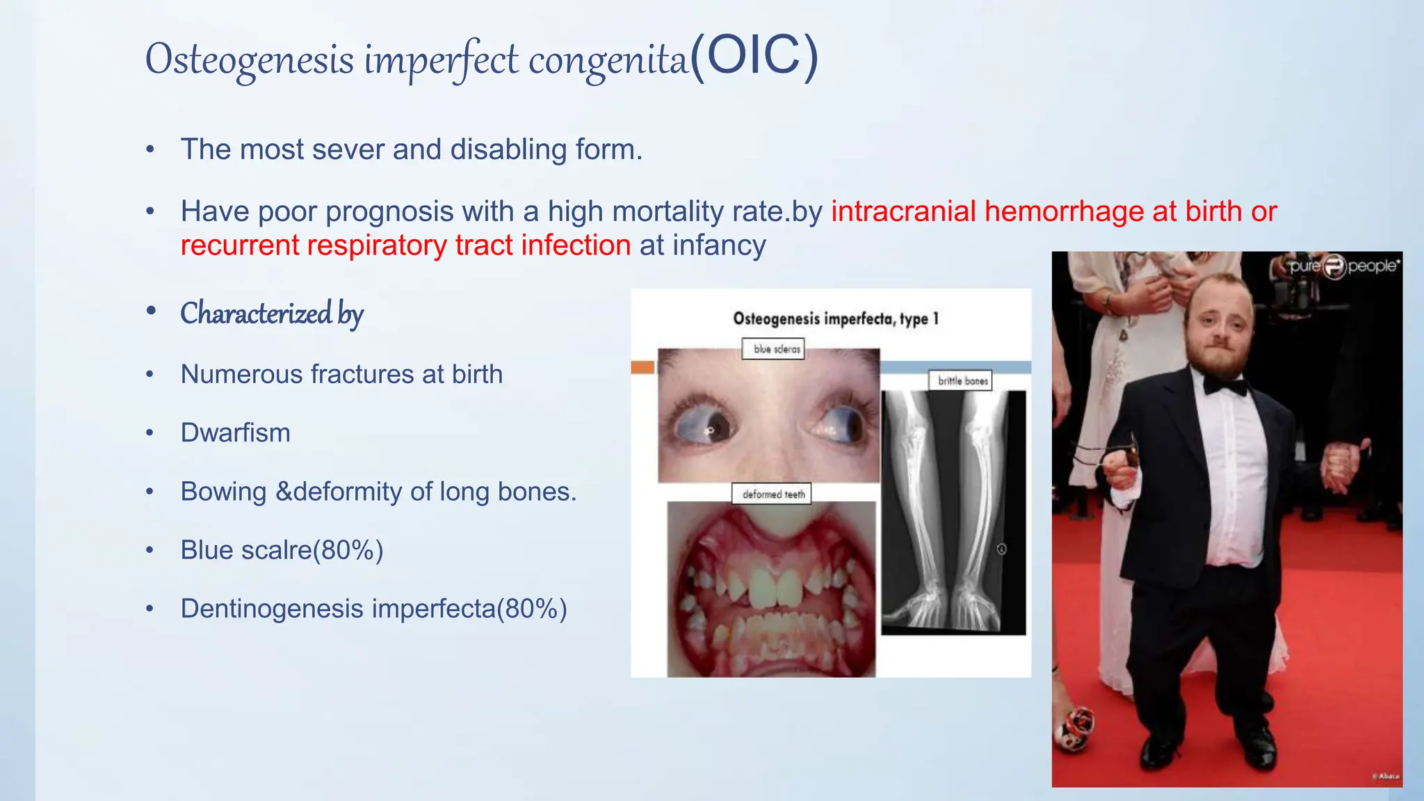 osteogenisis imperfecta radiology...pptx