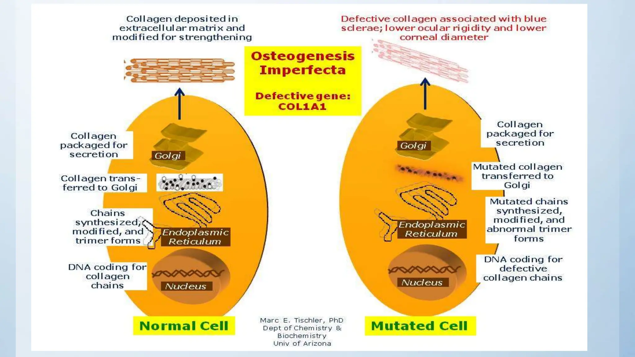 osteogenisis imperfecta radiology...pptx