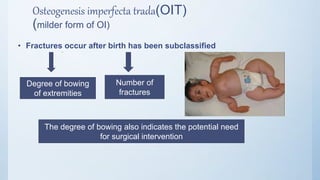 osteogenisis imperfecta radiology...pptx | Bone and Joint Conditions ...