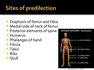 Osteoid+Osteoma | PPT