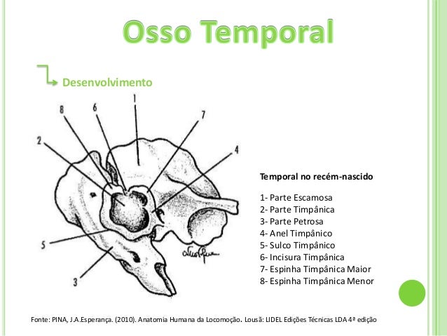 Osso/Bone/Hueso Temporal - Osteologia