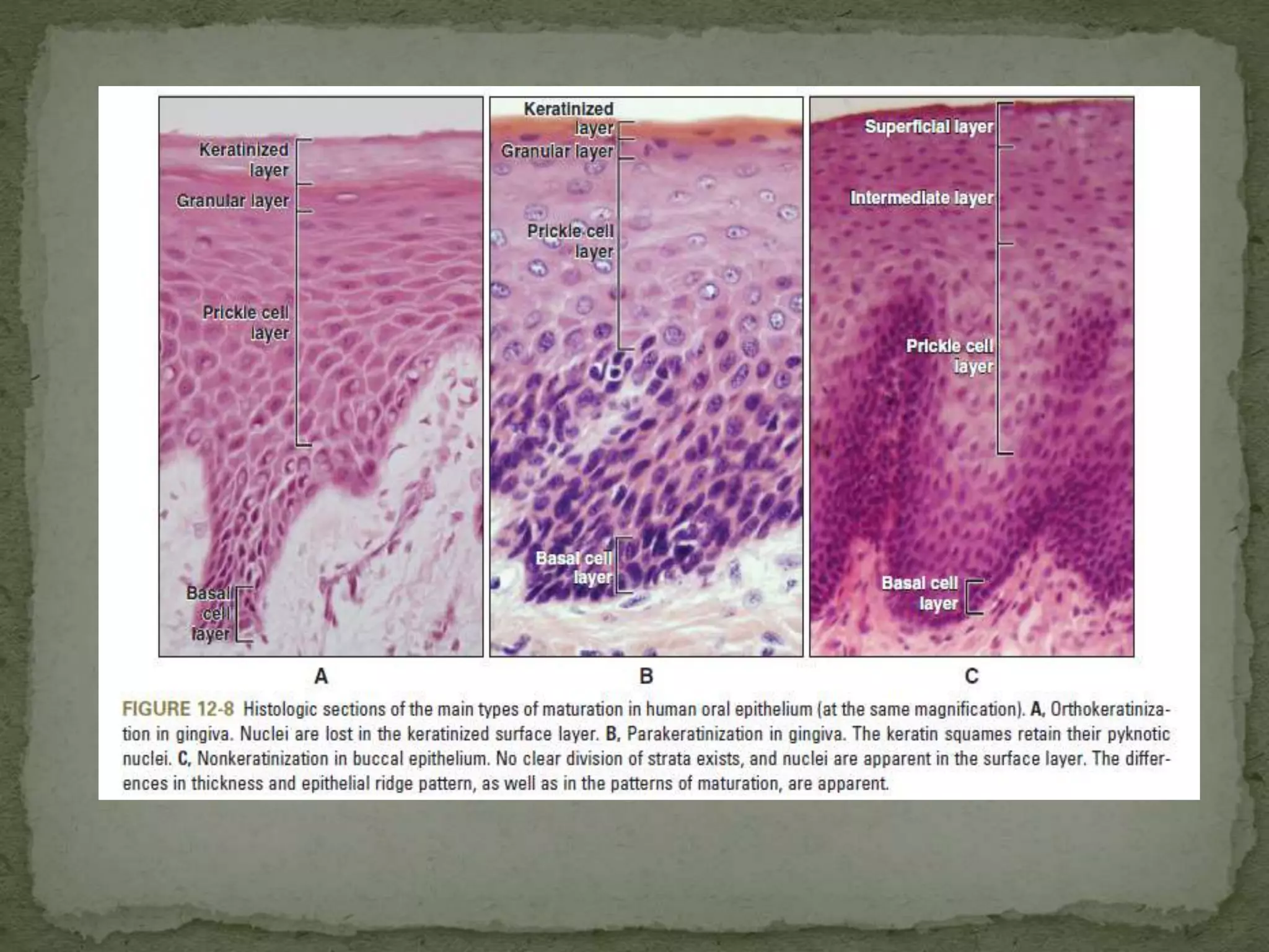 Osteology and mucose membrane of maxi & mandible | PPTX
