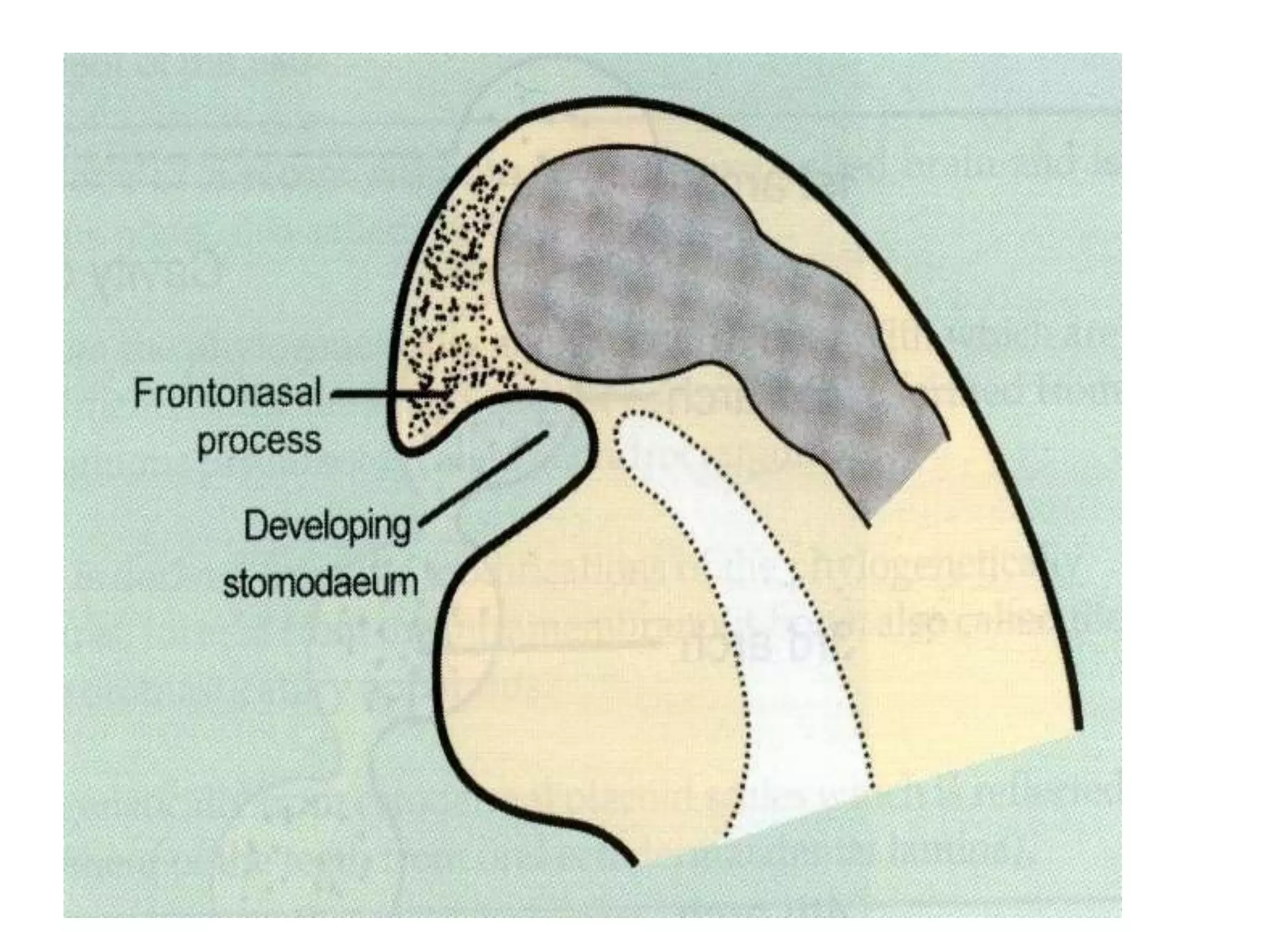Osteology of facial bones | PPT