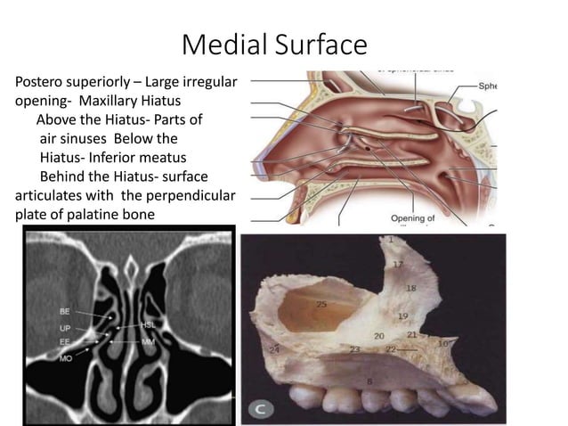 Osteology of facial bones | PPT