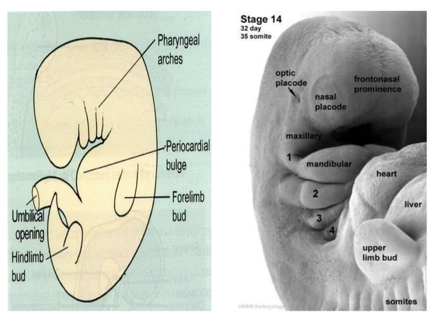 Osteology of facial bones | PPT