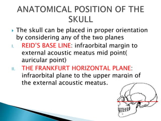 Osteology of head and neck | PPTX