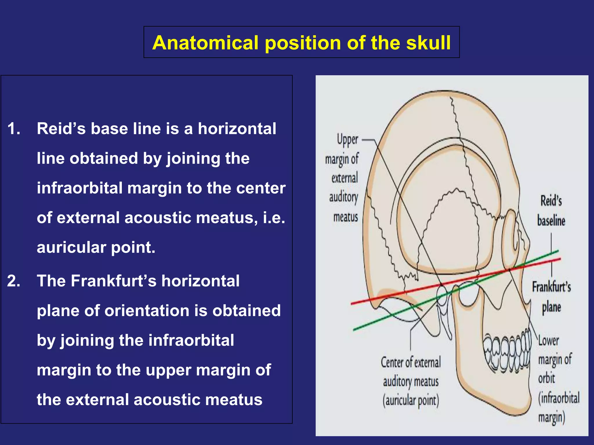 Osteology of Human Skull.pptx