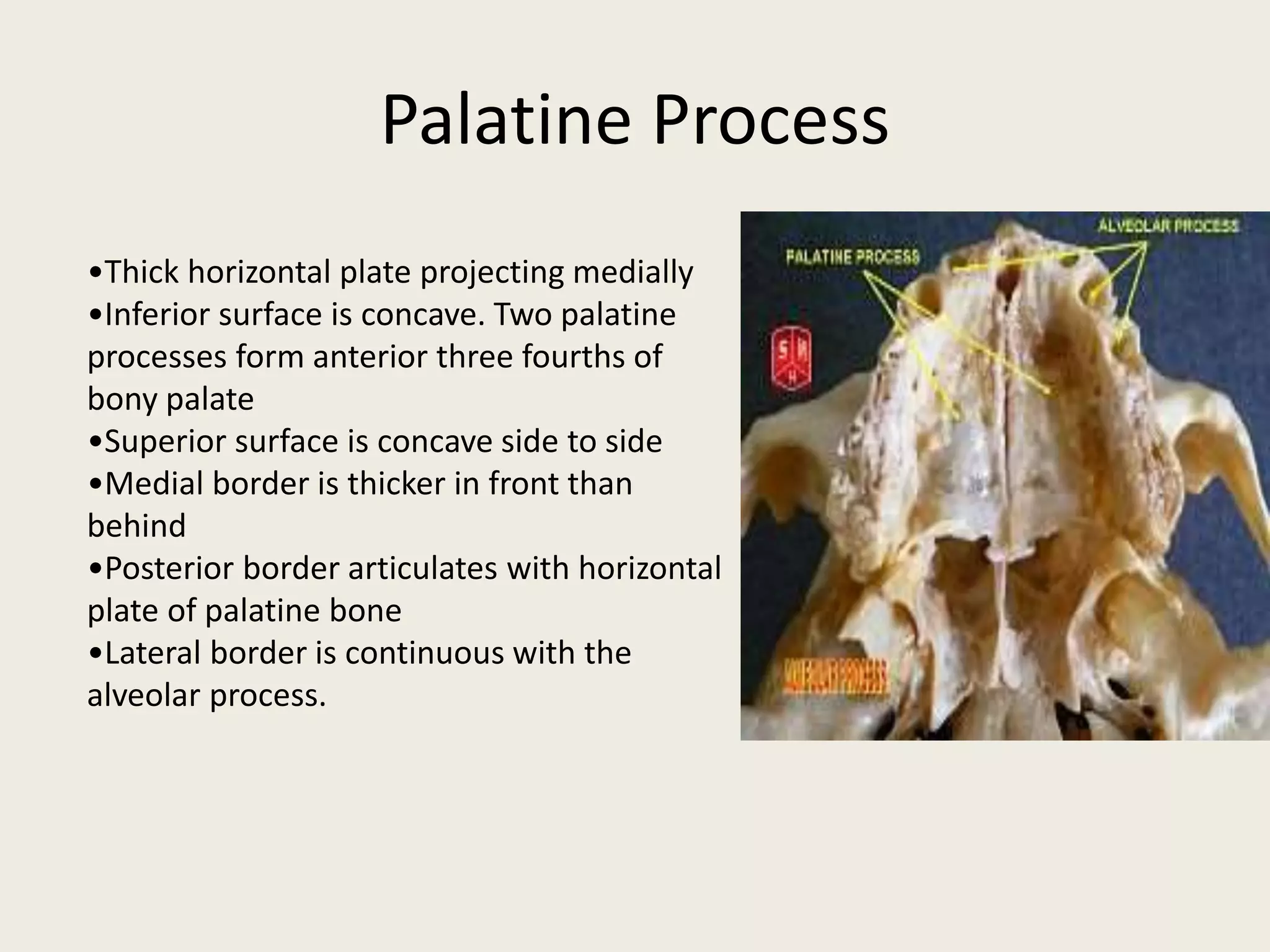 Osteology of Maxilla | PPTX
