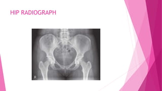 OSTEOLOGY OF THE HIP JOINT presentattion.pptx
