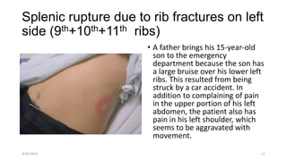 Osteology of thoracic cage | PPTX