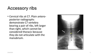 Osteology of thoracic cage | PPTX
