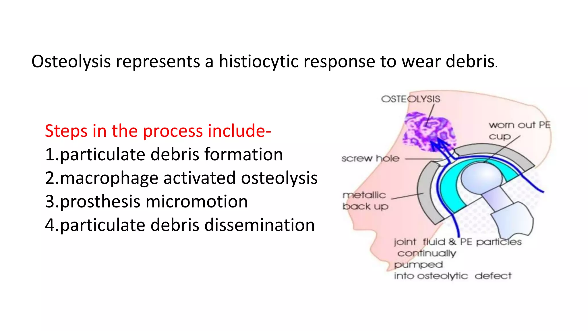 OSTEOLYSIS AND LOOSENING OF total hip arthroplasty IMPLANTS.pptx by dr ...