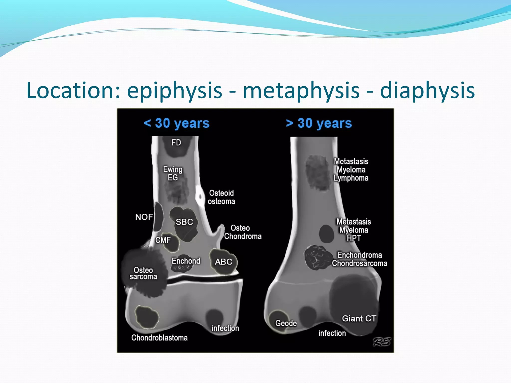 Osteolytic lesions of Bone | PPT