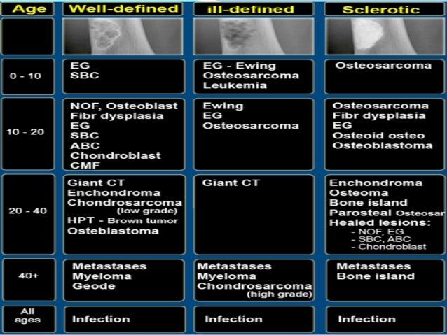 Osteolytic lesions of Bone