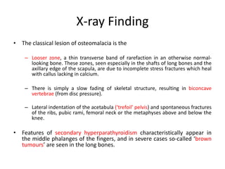 Osteomalacia | PPTX