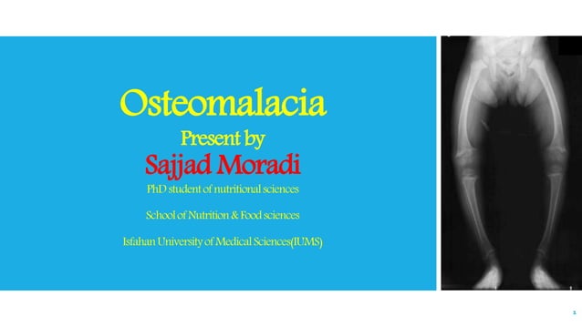 Osteomalacia | PPTX | Bone and Joint Conditions | Diseases and Conditions