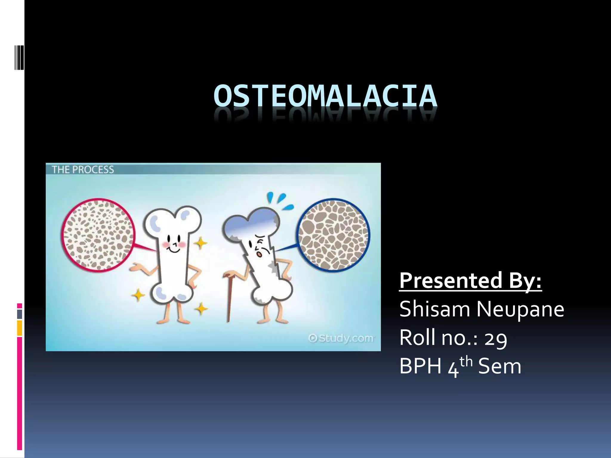Osteomalacia | PPTX