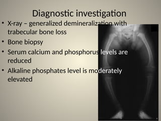 osteomalacia-with-paget-disease-don.pptx
