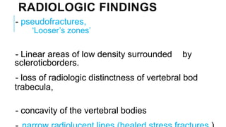 Osteomalacia and rickets | PPTX