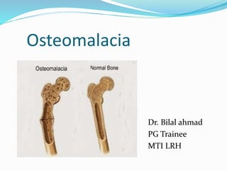 Osteomalacia new org | PPTX