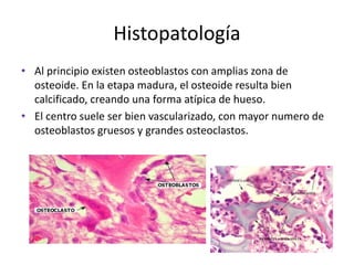OSTEOMA OSTEOIDE.pptx