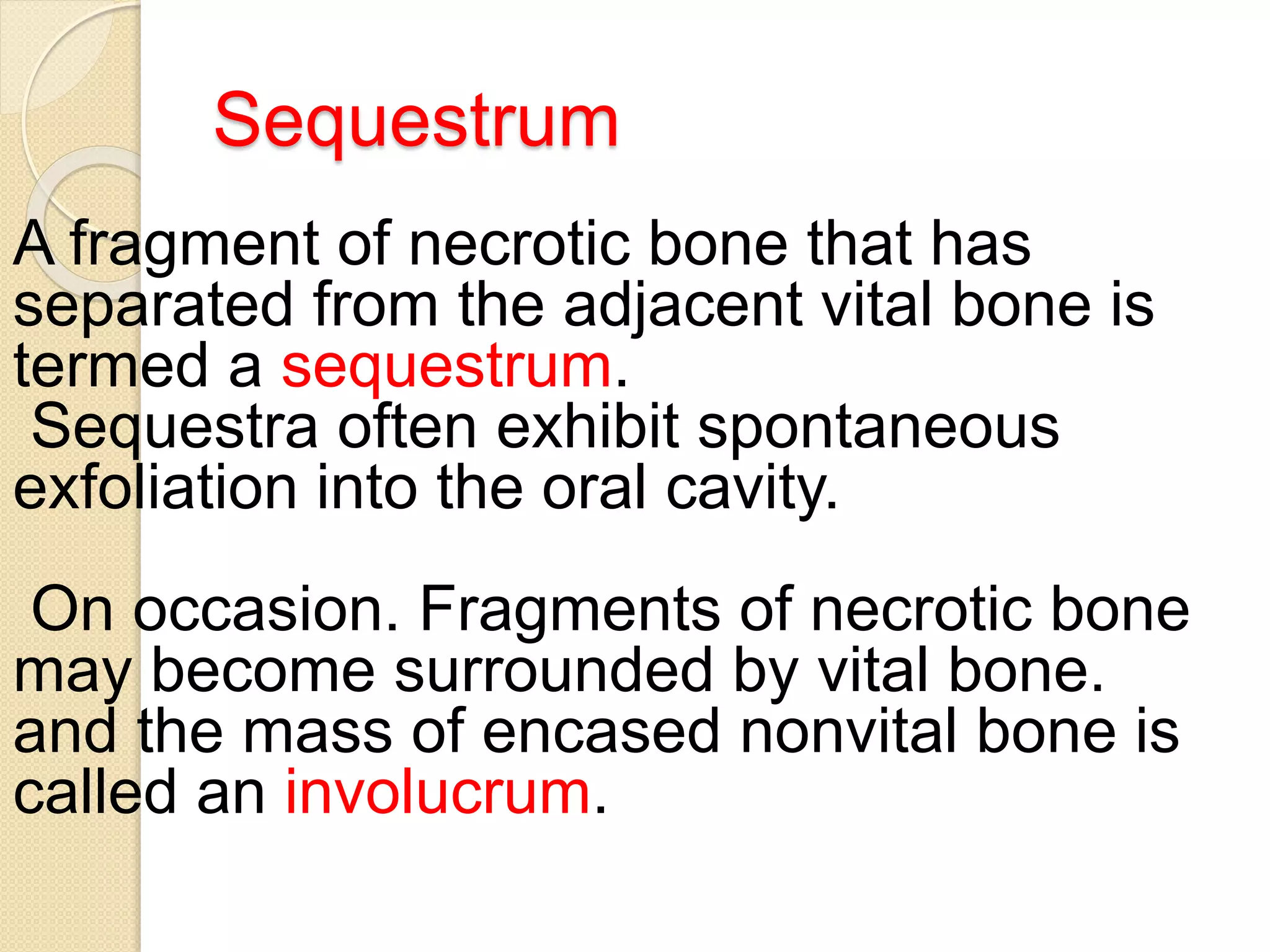 Osteomielitis | PPTX