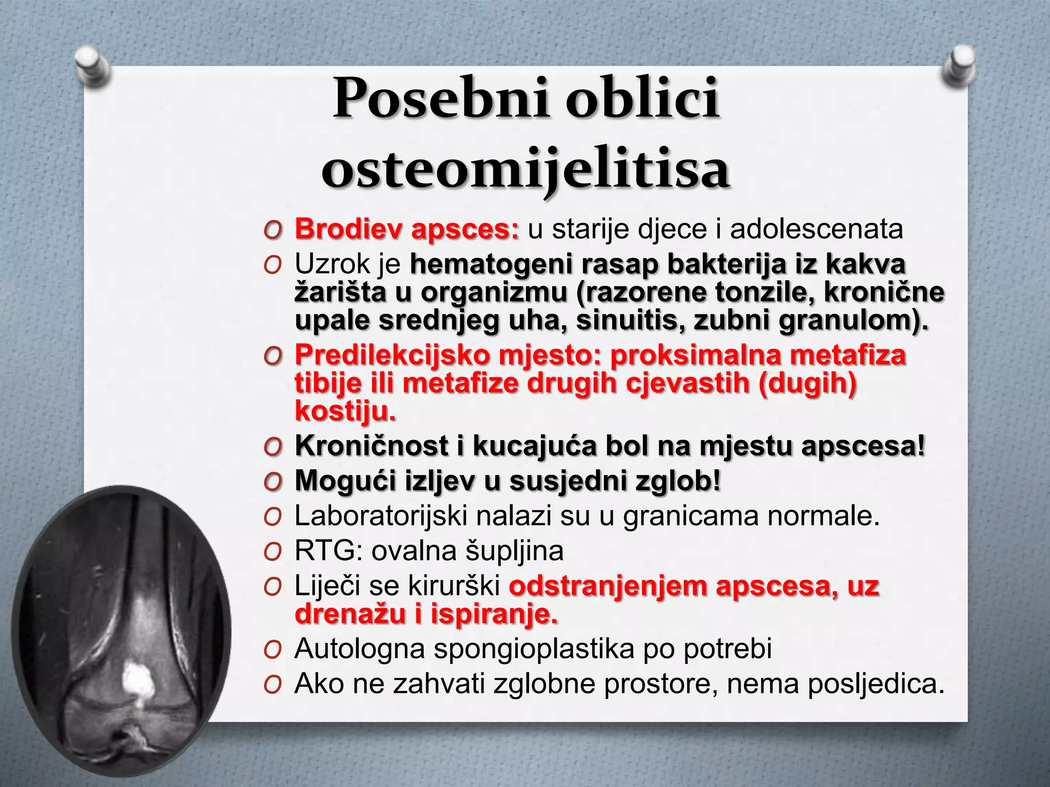 Osteomijelitis | PPSX