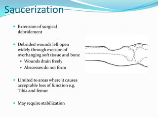 Osteomyelitis | PPT