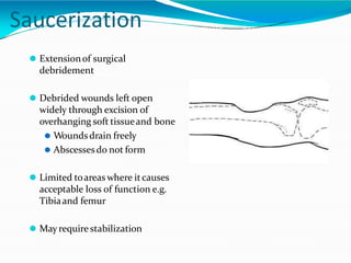 osteomyelitis-130708212636-phpapp01 (1).pptx