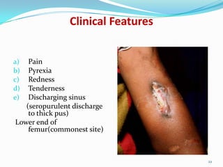 Osteomyelitis | PPT