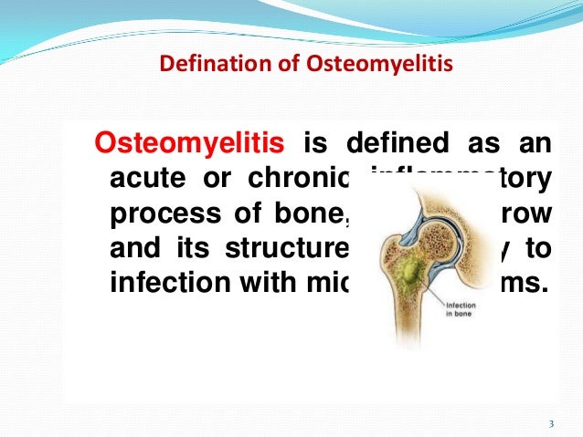 Osteomyelitis
