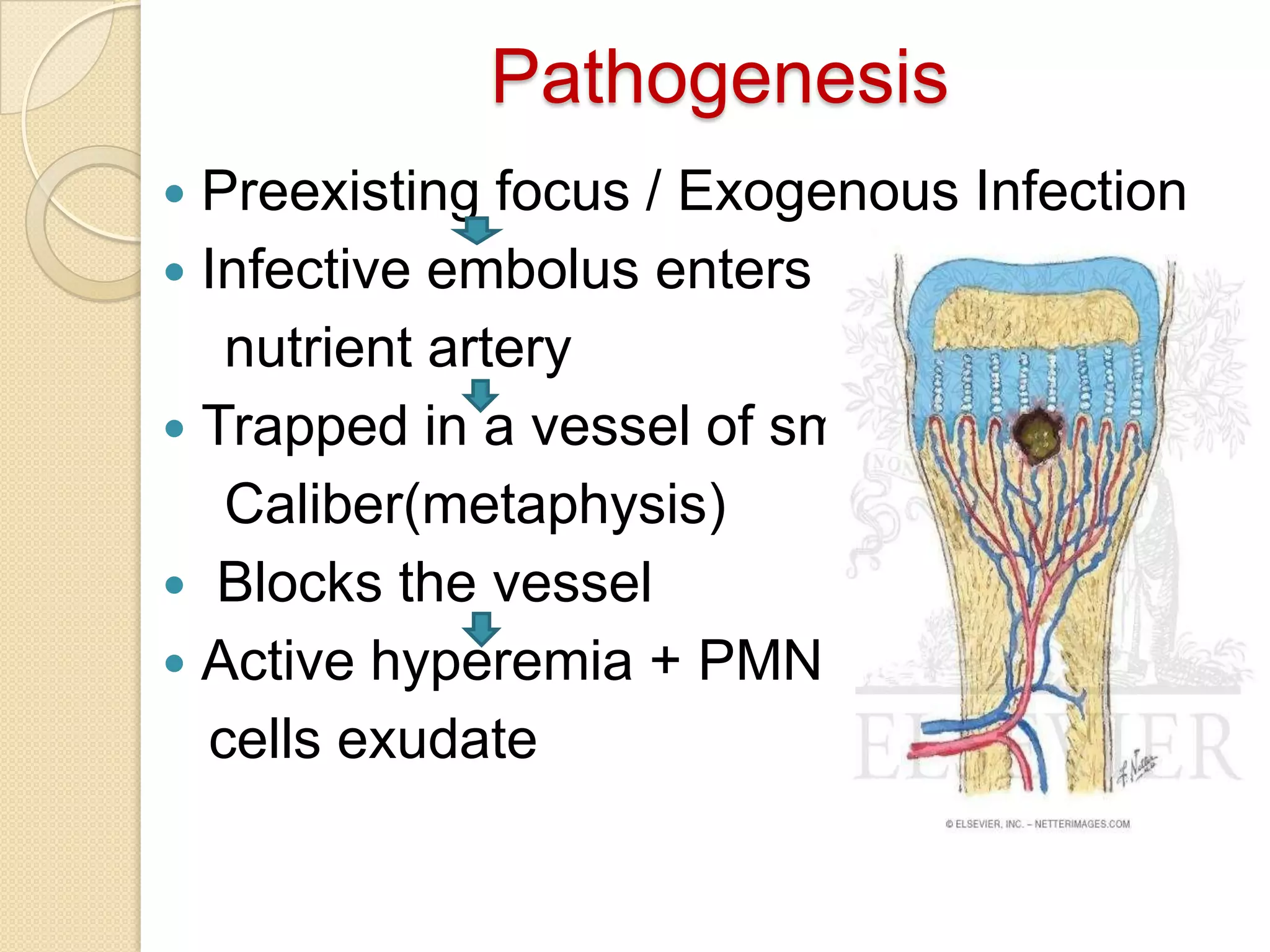 Acute and Chronic Osteomyelitis - Infection of Bone | PPTX