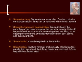 Osteomyelitis | PPT