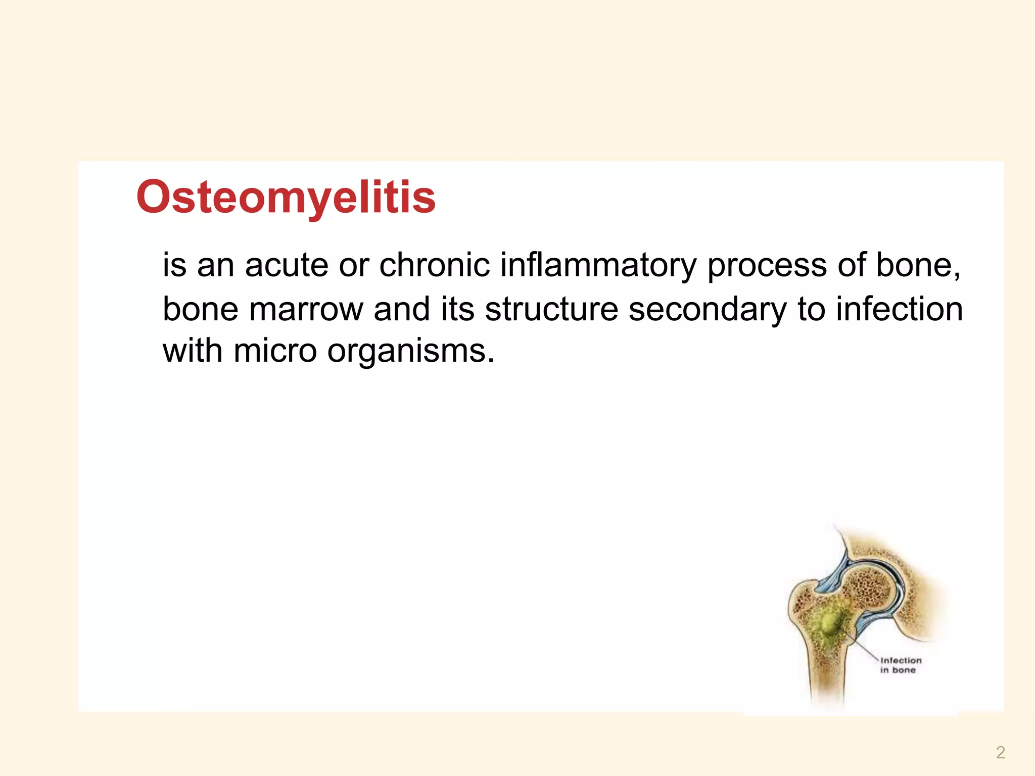 Osteomyelitis | PPTX