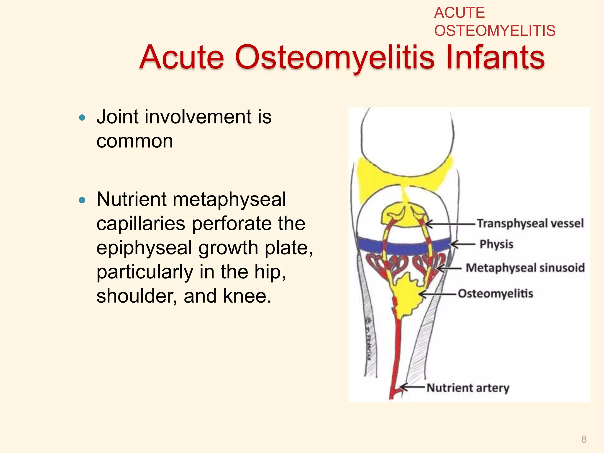Osteomyelitis | PPTX