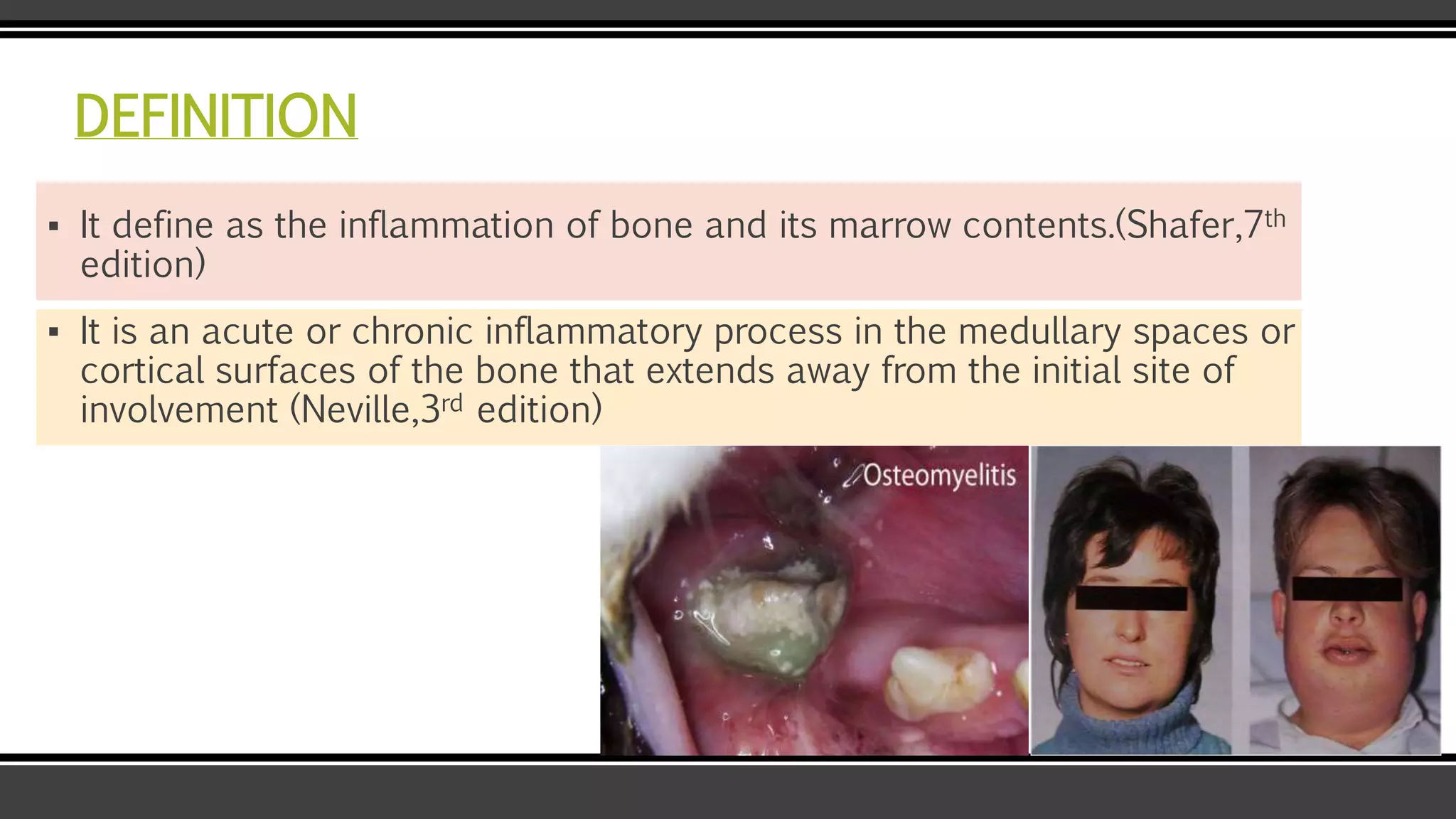 Osteomyelitis | PPTX