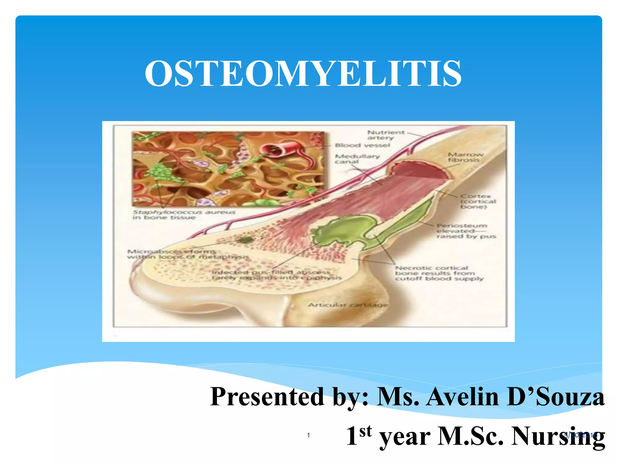 Osteomyelitis | PPTX