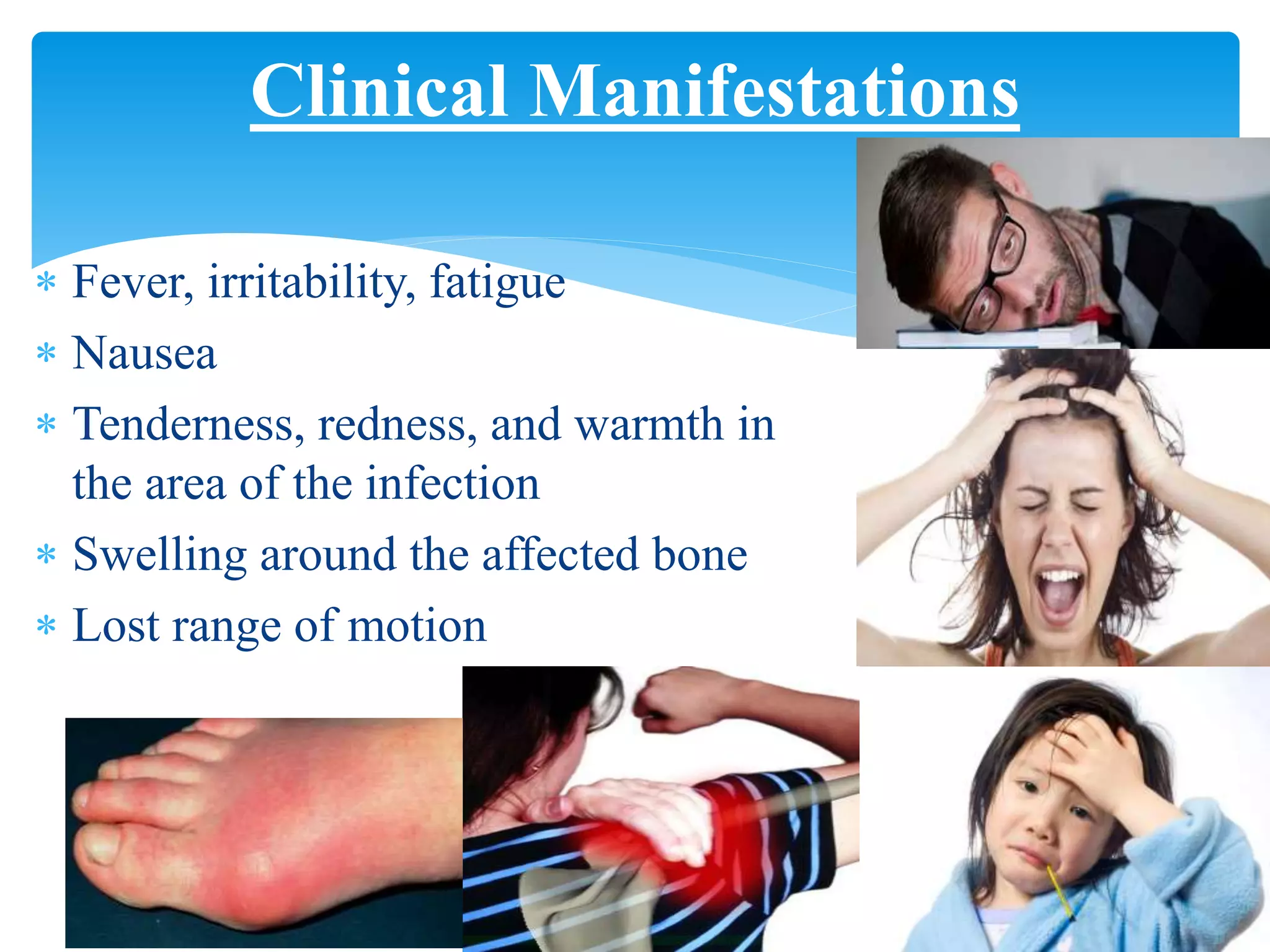 Osteomyelitis | PPTX