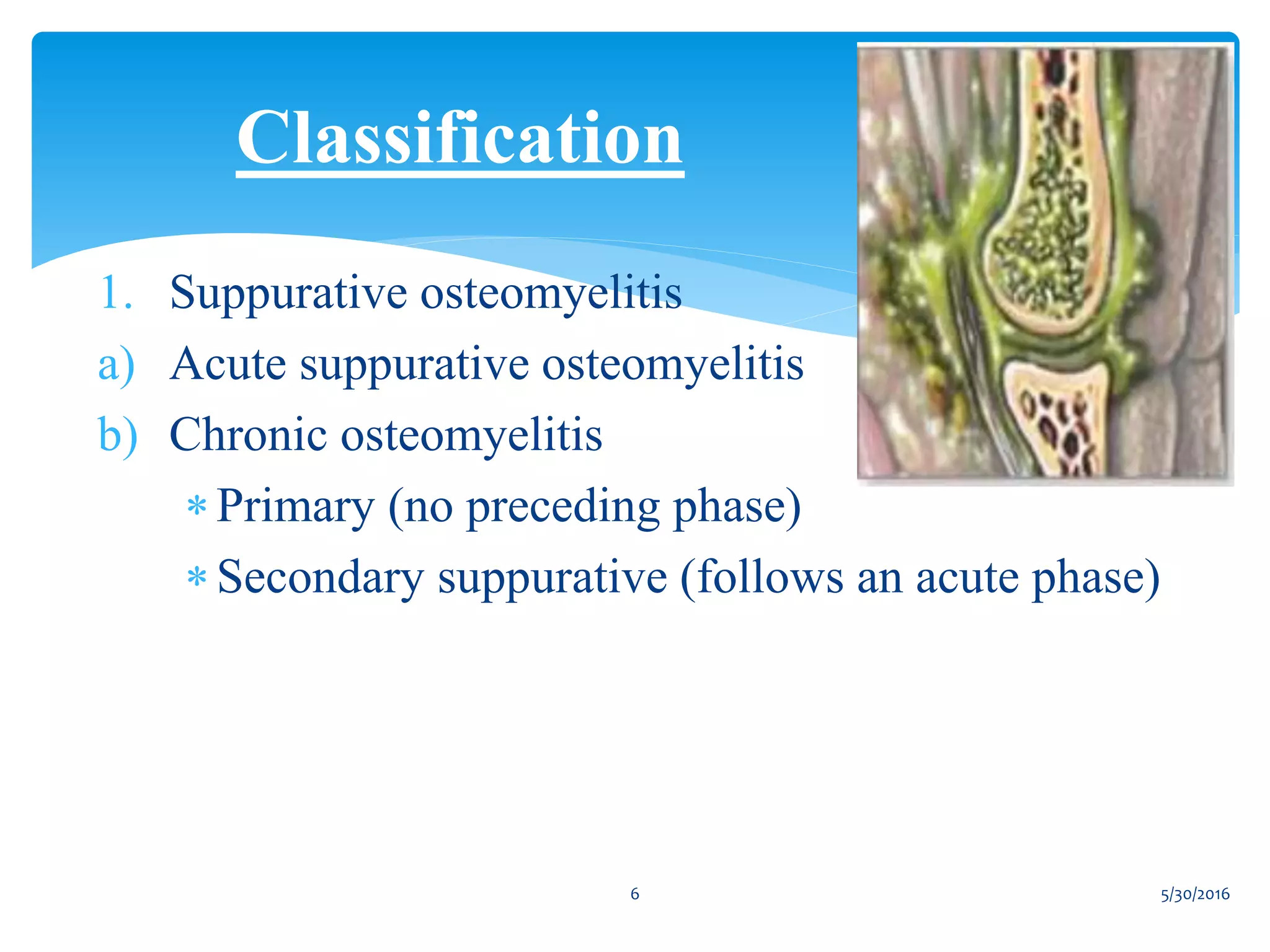 Osteomyelitis | PPTX