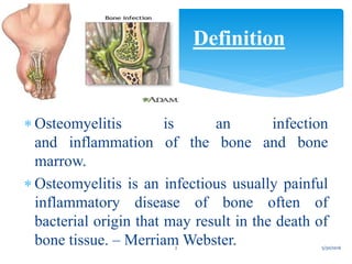 Osteomyelitis | PPT
