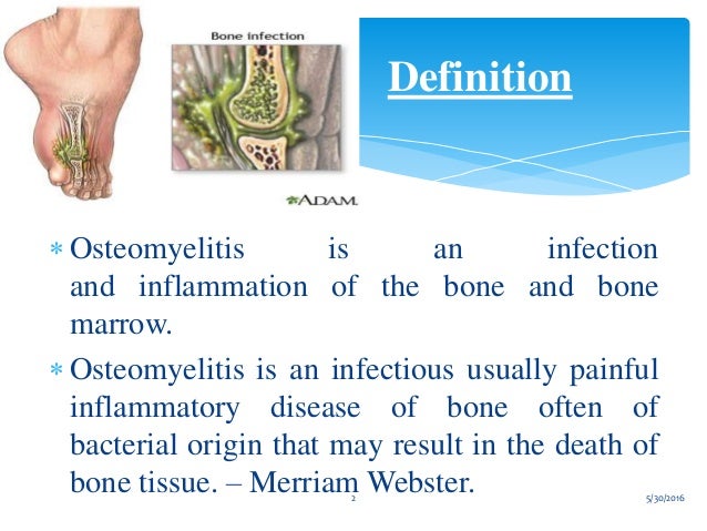 Osteomyelitis