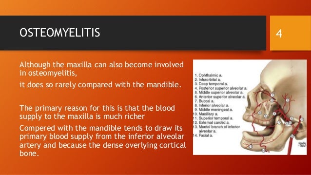 Osteomyelitis (Dentistry)