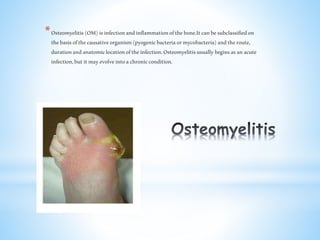 Osteomyelitis | PPTX