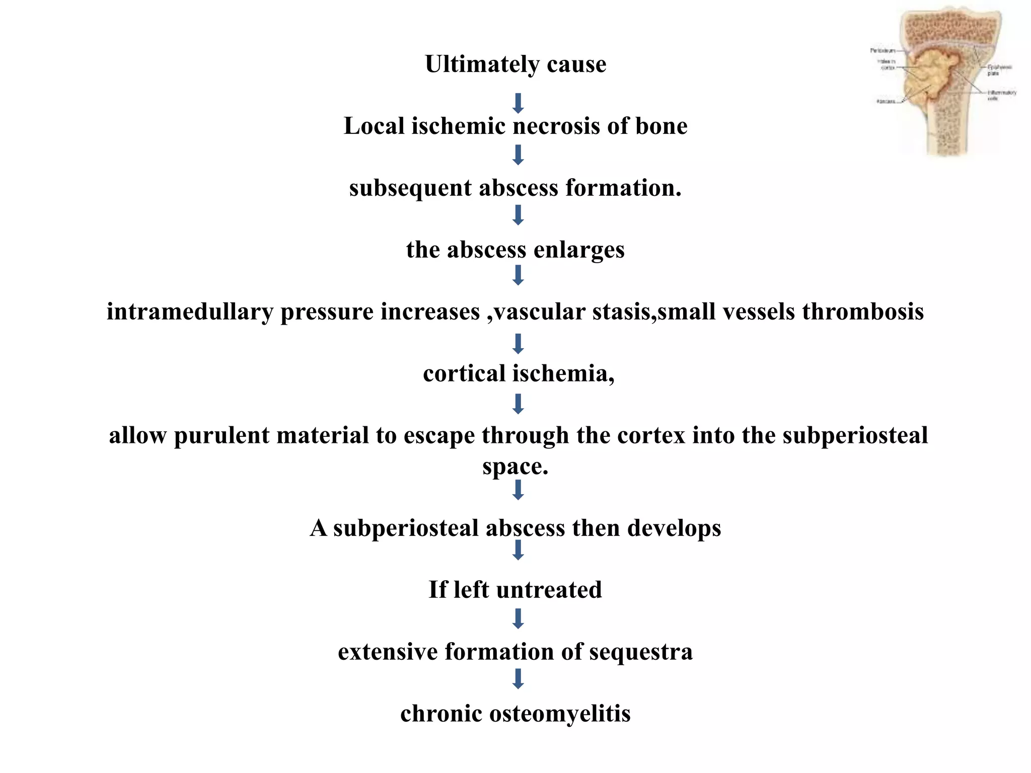 Osteomyelitis | PPTX