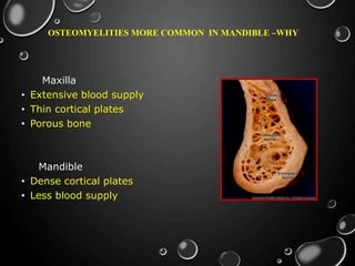 Osteomyelitis | PPTX