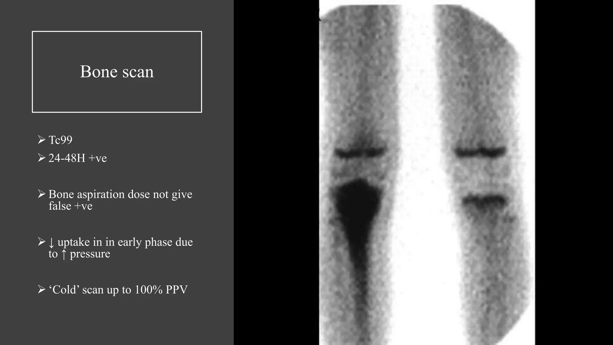 Osteomyelitis.2019pptx | PPT