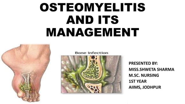 Osteomyelitis and its management | PPTX